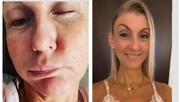 Association Française des Céphalées • L'association qui regroupe toutes ...